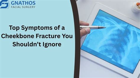 Top 7 Symptoms Of A Cheekbone Fracture You Shouldnt Ignore