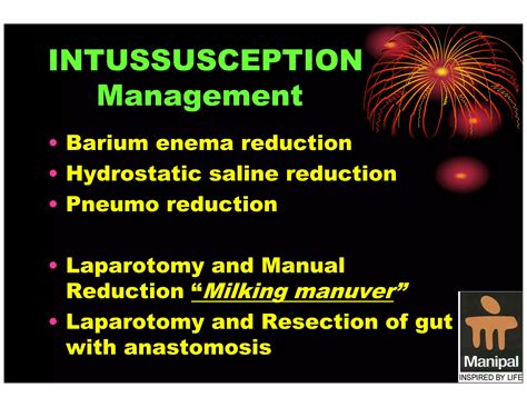 Pediatric Intussusception An Overview Pdf