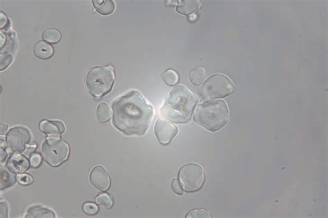 Particle Identification Analysis By Optical Microscopy Sesalab