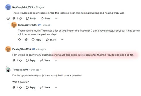 Srs And Grs Surgeons And Associated Horrors Page 1557 Kiwi Farms