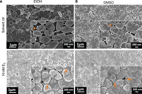 Frontiers Effects Of The Sex Steroid Hormone Estradiol On Biofilm