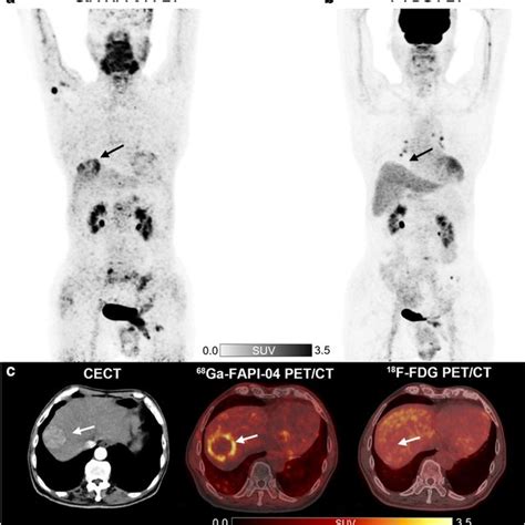 Structures Of Representative Fapi Based Tracers Used In Preclinical And