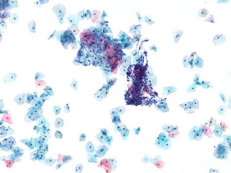 Tct Sample 菘毅系統股份有限公司