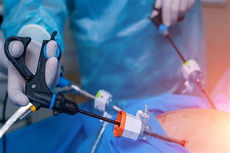 Radical Gastrectomy Surgery Hospital In Nagercoil Kanyakumari Stomach Cancer Treatment