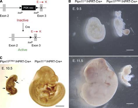 Global Ptpn11e76k Mutation Results In Embryonic Lethality A Download Scientific Diagram