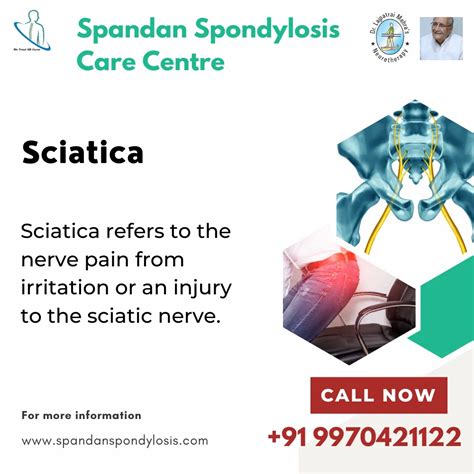 Sciatica Treatment At Rs In Bengaluru ID