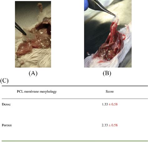 A Dense PCL B Porous PCL In The Abdomen More Intestinal Adhesion Download Scientific