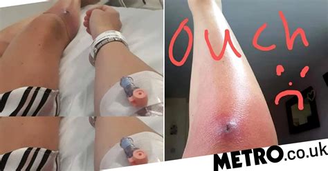 Mum Almost Died From Spider Bite After She Contracted Sepsis Metro News
