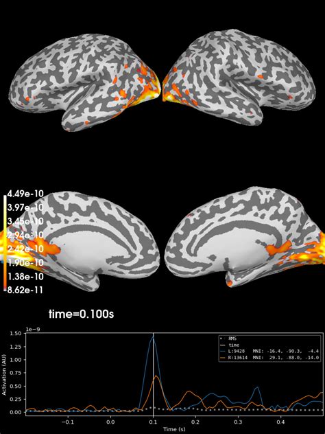 Overview Of MEG EEG Analysis With MNE Python MNE Documentation