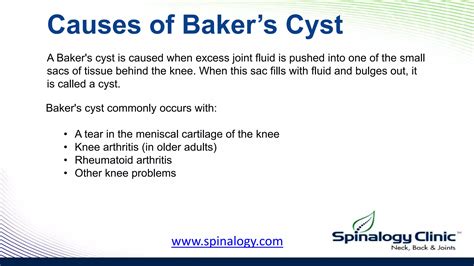 Bakers Cyst Symptoms Causes Diagnosis And Treatment Pptx