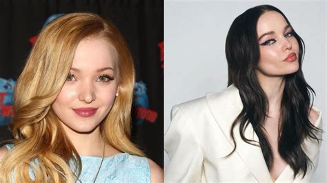 Dove Camerons Before Plastic Surgery Speculations Of Multiple
