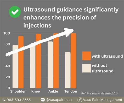 Ultrasound Guided Injection การฉีดยาโดยใช้อัลตราซาวด์นำทาง