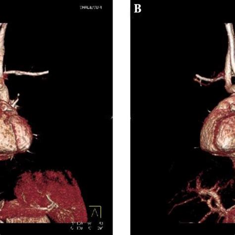 Three Dimensional Computed Tomography Download Scientific Diagram