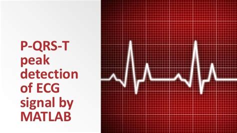 p qrs t peak detection of ecg signal by matlab