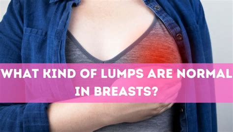 Breast Lump Identification Breast Lumps Types Benign Moveable