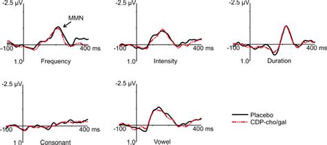 Frontal Fz Erp Grand Averaged Subtracted Difference Waveforms
