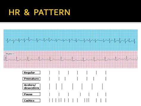 Ppt Ecg And Machine Principles Powerpoint Presentation Free Download