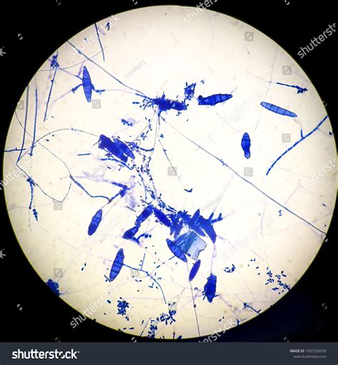 Microsporum Gypseum
