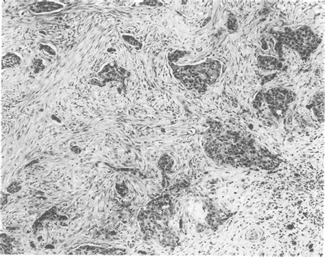 Figure 3 From A Microdissection Technique For Archival Dna Analysis Of
