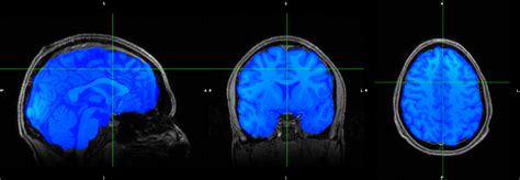 Github Elinepppcneuroscience A Collection Of The Neuroscience