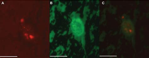 Lectin Staining Of A Biofilm Associated Polysaccharide Matrix