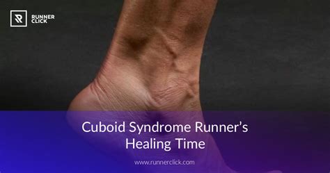Cuboid Syndrome Symptoms Prevention Treatments