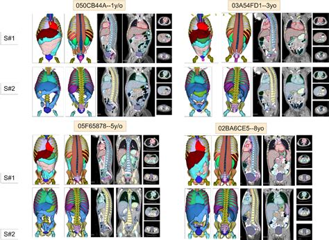 Development And Validation Of Fully Automated Robust Deep Learning