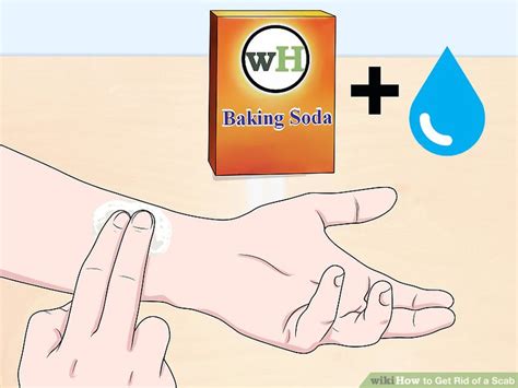 How To Get Rid Of A Scab Steps With Pictures WikiHow