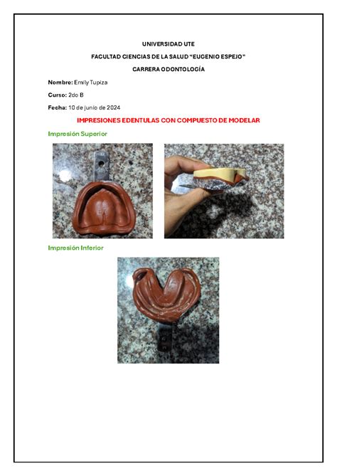 Impresiones Edentulas Con Godiva Odontología Universidad Ute