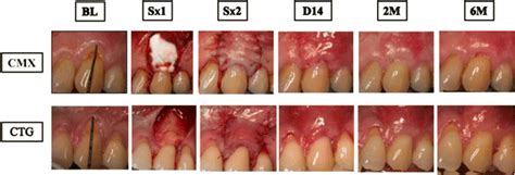 Clinical Pictures Of One Representative Case From The Xenogeneic Download Scientific Diagram