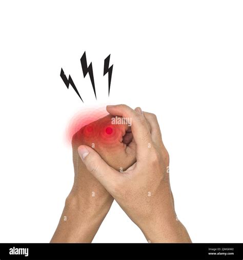 Metacarpophalangeal Joints