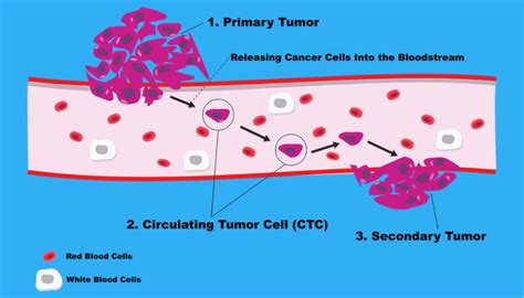 Circulating Tumor Cells Cancer Research For A Cure