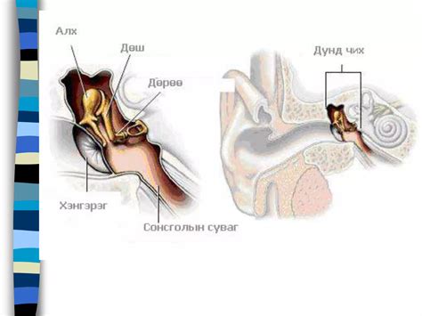Дунд чихний архаг үрэвсэл Pptx