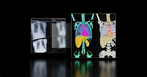 Annotate And Adapt Medical Imaging Models With Monai Nvidia