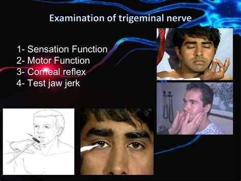 Trigeminal Nerve Examination