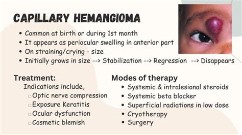 Orbital Tumors In Opthalmology Ppt