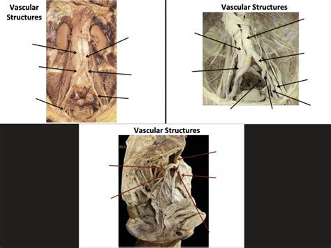 Lab 6 Vascular Structures Diagram Quizlet