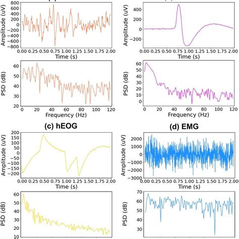Examples Of Segments In Eegdenoisenet Dataset A An Eeg Segment B