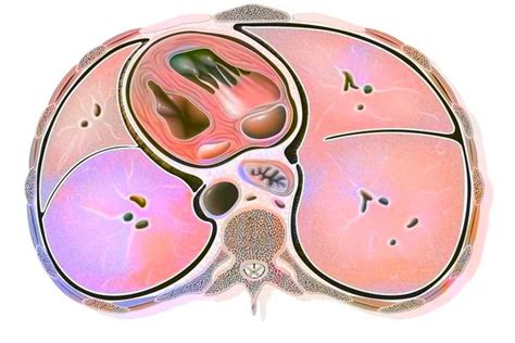 Interventricular Sulcus And Septum