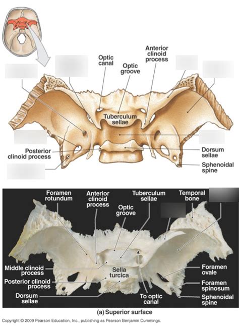 Middle Clinoid Process