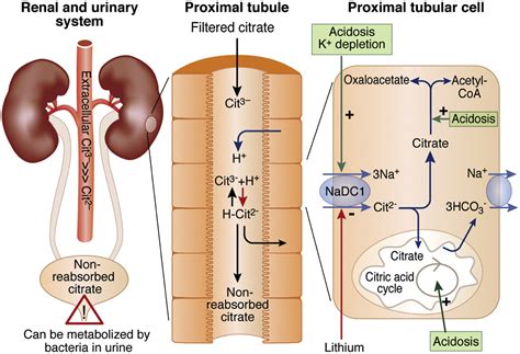 Hypocitraturia Urologic Clinics