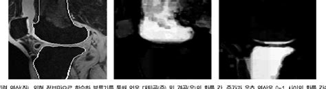 Figure 1 From Classification Based Knee Bone Detection Using Context