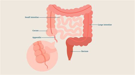 Appendix What Is It And What Does It Do