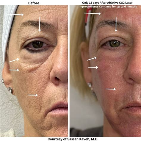 Blog Alpha Medical Aesthetics