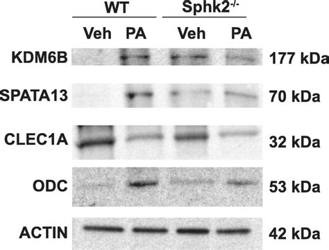 validation by western blot of differentially regulated genes in