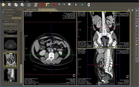 best 14 open source and free dicom viewers linux mac osx and windows