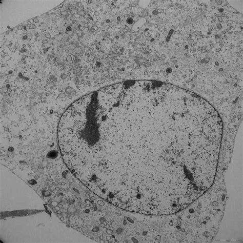 How Cells Die In Ferroptosis Neuroscience News