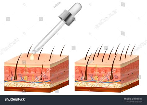 Treatment Alopecia Vitamins Hair Number Hair Stock Vector Royalty Free 2466756483 Shutterstock