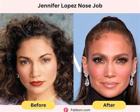 51 Most Popular Celebrity Nose Jobs Before And After With Images Fabbon