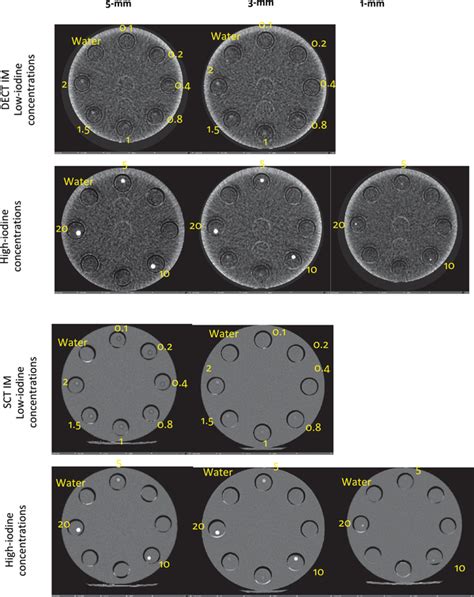 Dual‐energy Computed Tomography Dect And Subtraction Computed Download Scientific Diagram